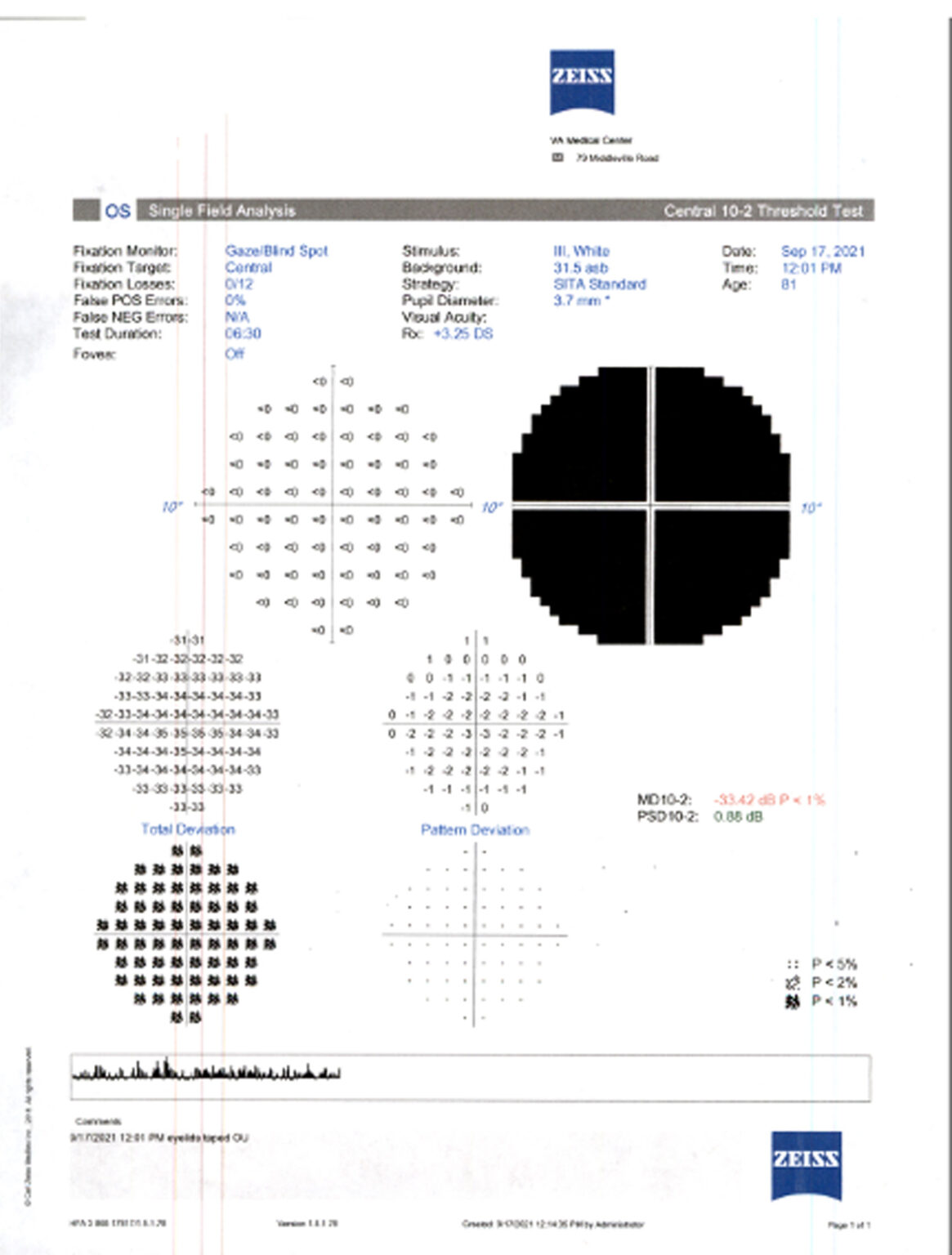 Navigating Visual Field Loss, Visual Neglect, and Ocular Dominance ...